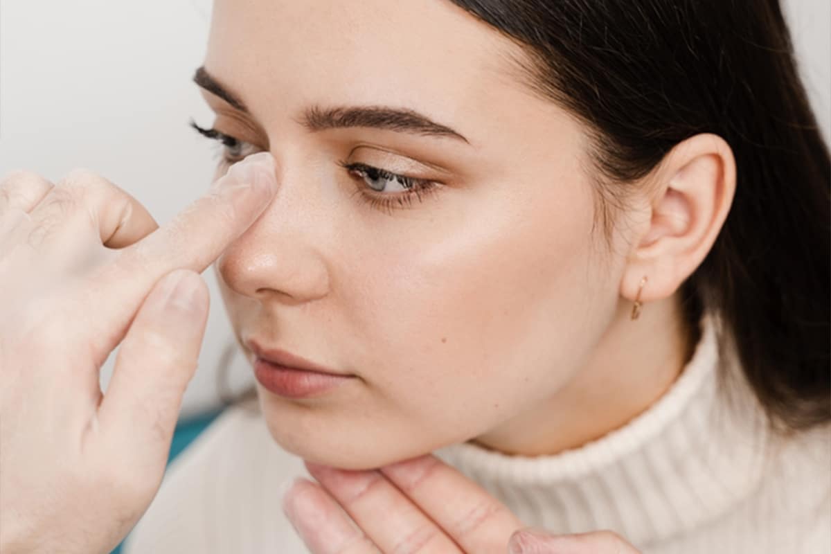 Teenage Nose Jobs: What to Know Before Deciding